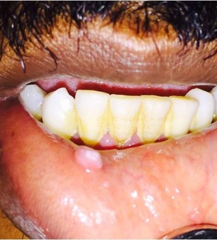 Tagore Dental College